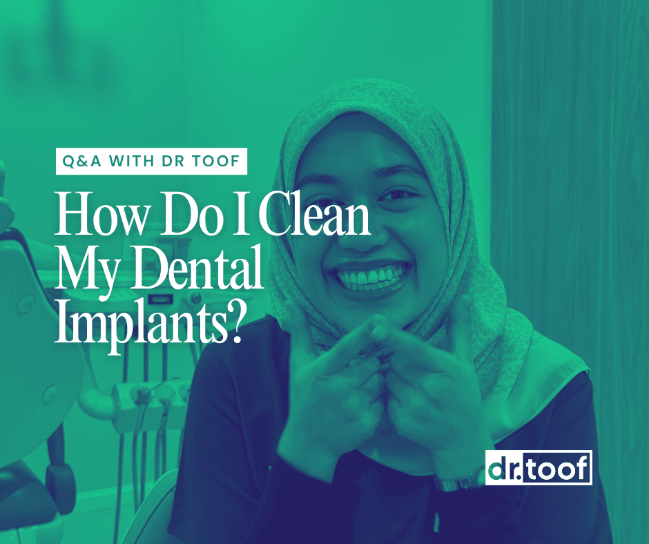 How do I clean my dental implants? - Dr Toof Dental